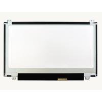 Tela 116 Acer C710 q1vzc Chromebook