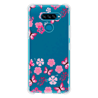 Capinha De Celular Com Lg K50s Personalizada